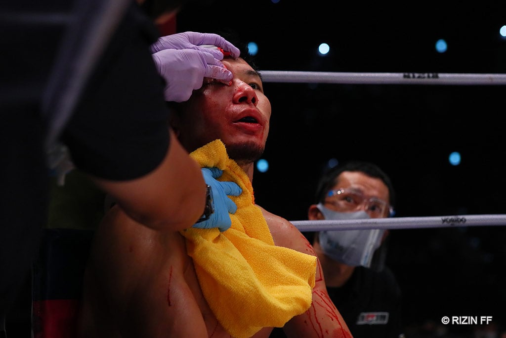 【格闘技／rizin 31】フェザー級新王者に牛久絢太郎 斎藤裕「できる、できるよ！」の声も虚しく流血ドクターストップ Spread